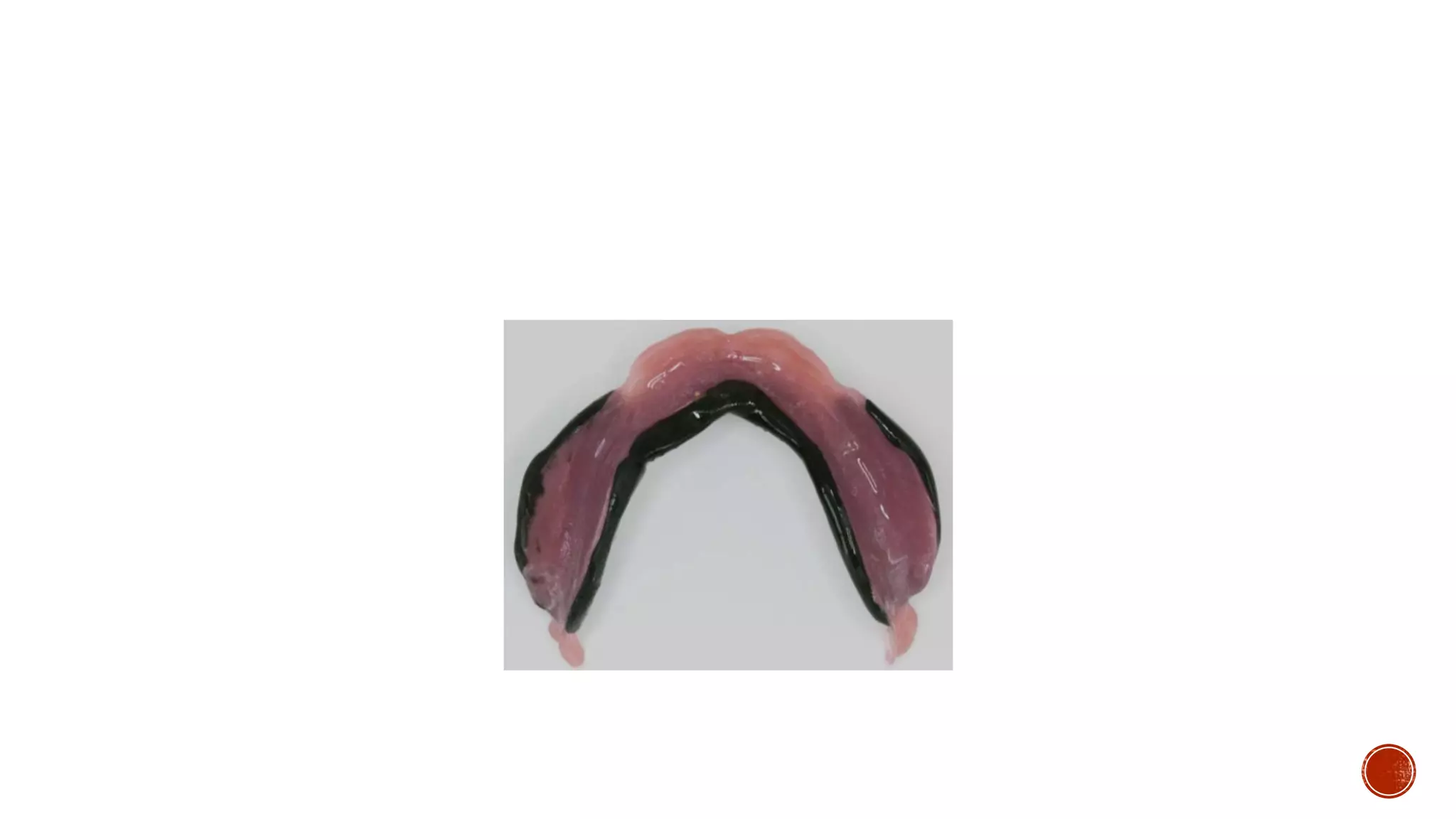 COMPLETE DENTURE PROSTHO.pptx