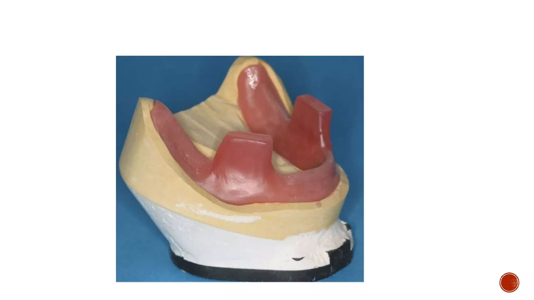 COMPLETE DENTURE PROSTHO.pptx