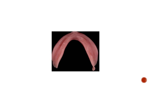 COMPLETE DENTURE PROSTHO.pptx