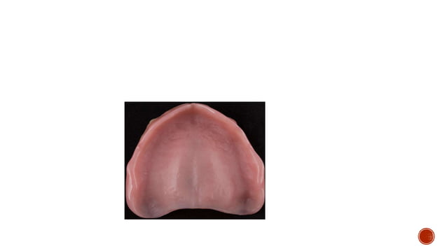 COMPLETE DENTURE PROSTHO.pptx