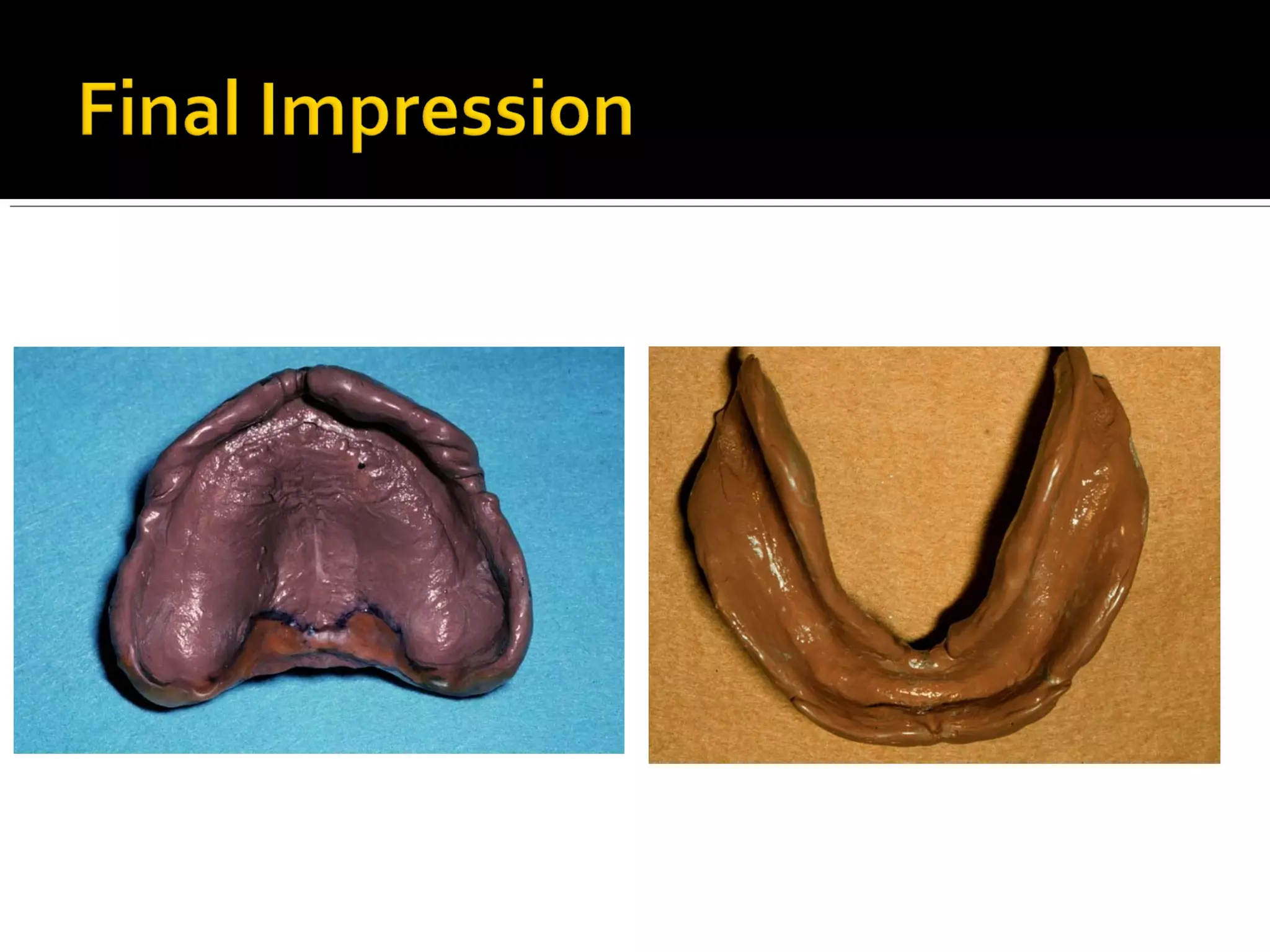 Complete denture prosthodontics step by step | PPT