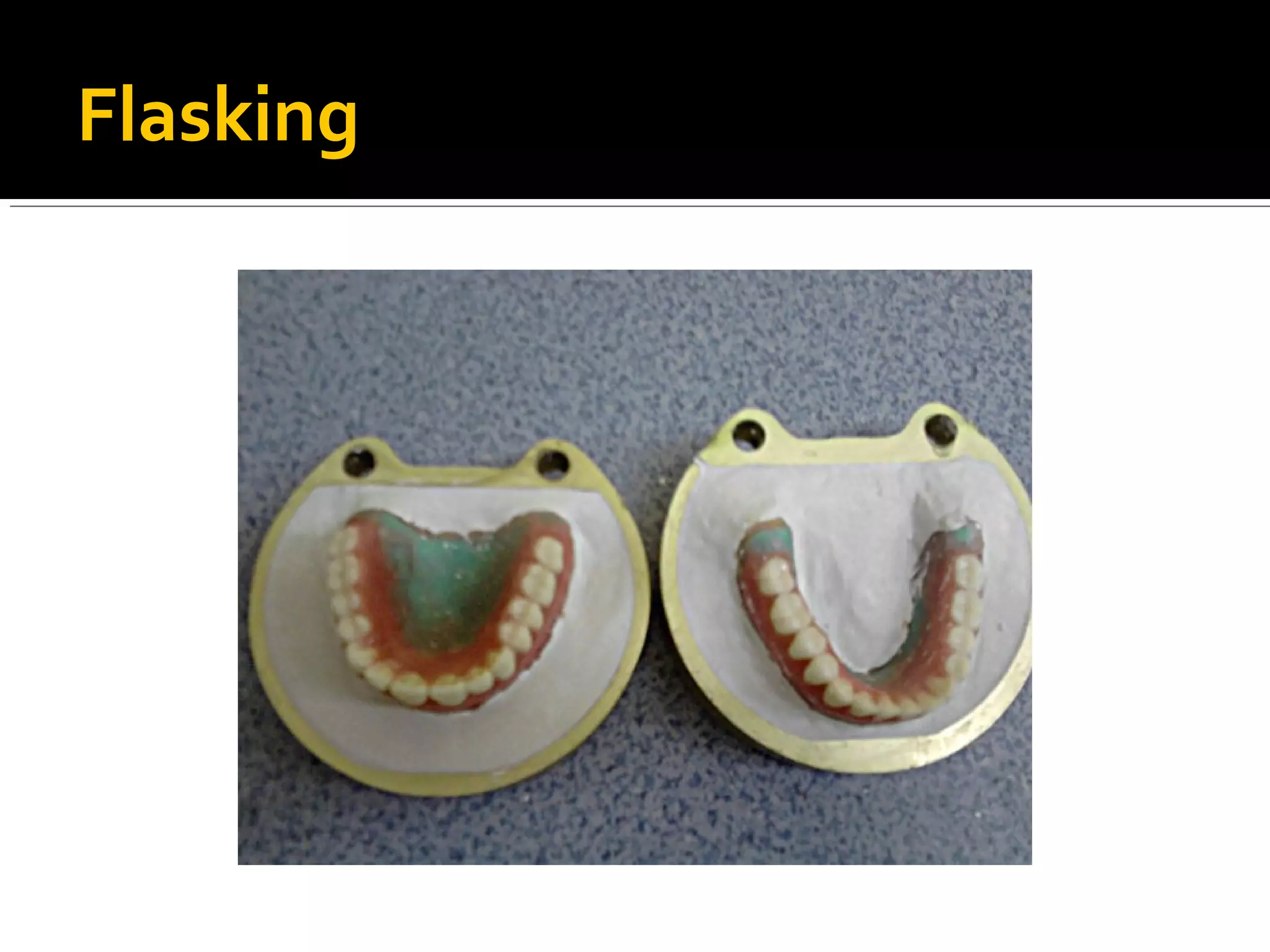 Complete denture prosthodontics step by step | PPT