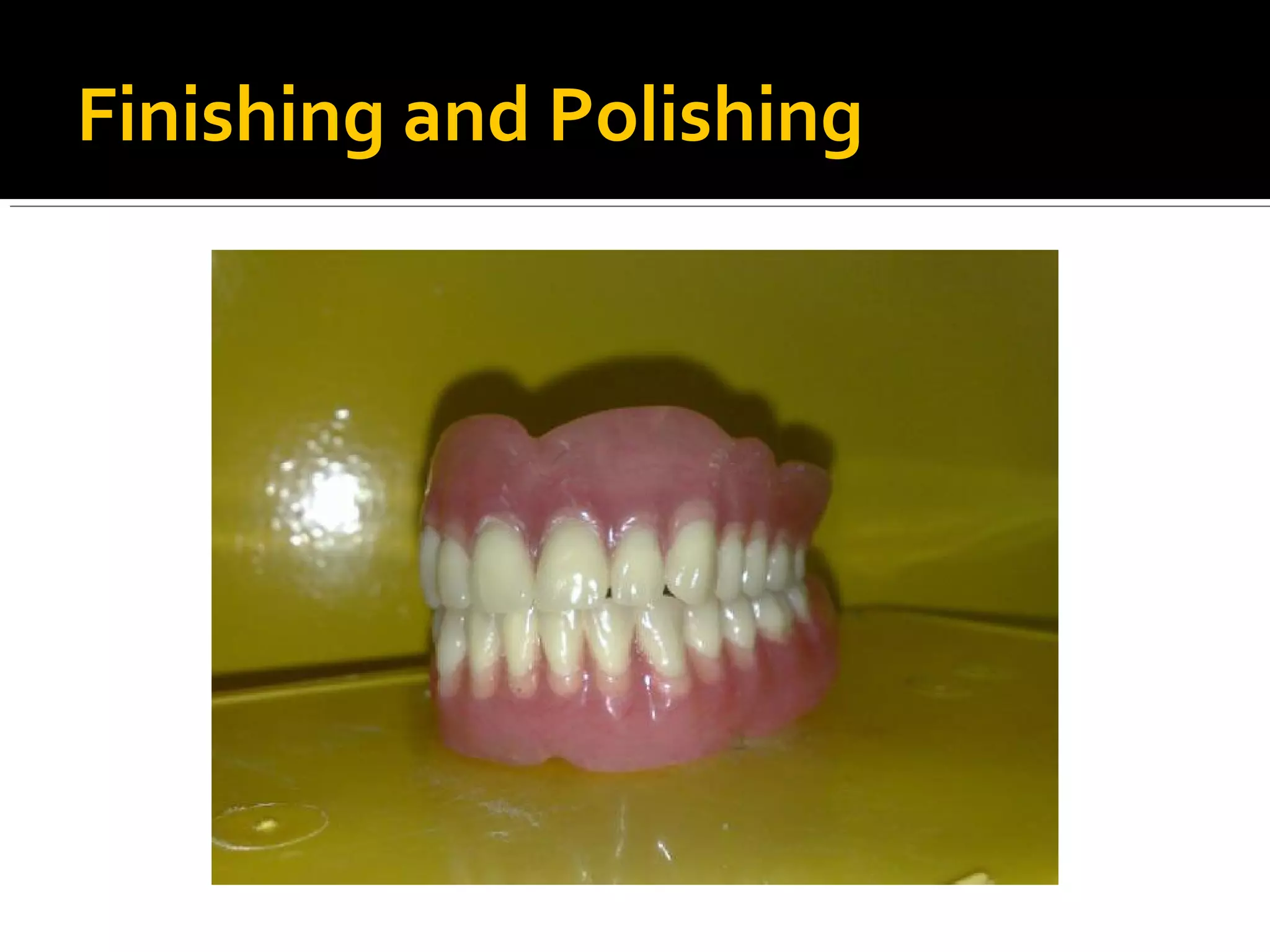 Complete denture prosthodontics step by step | PPT