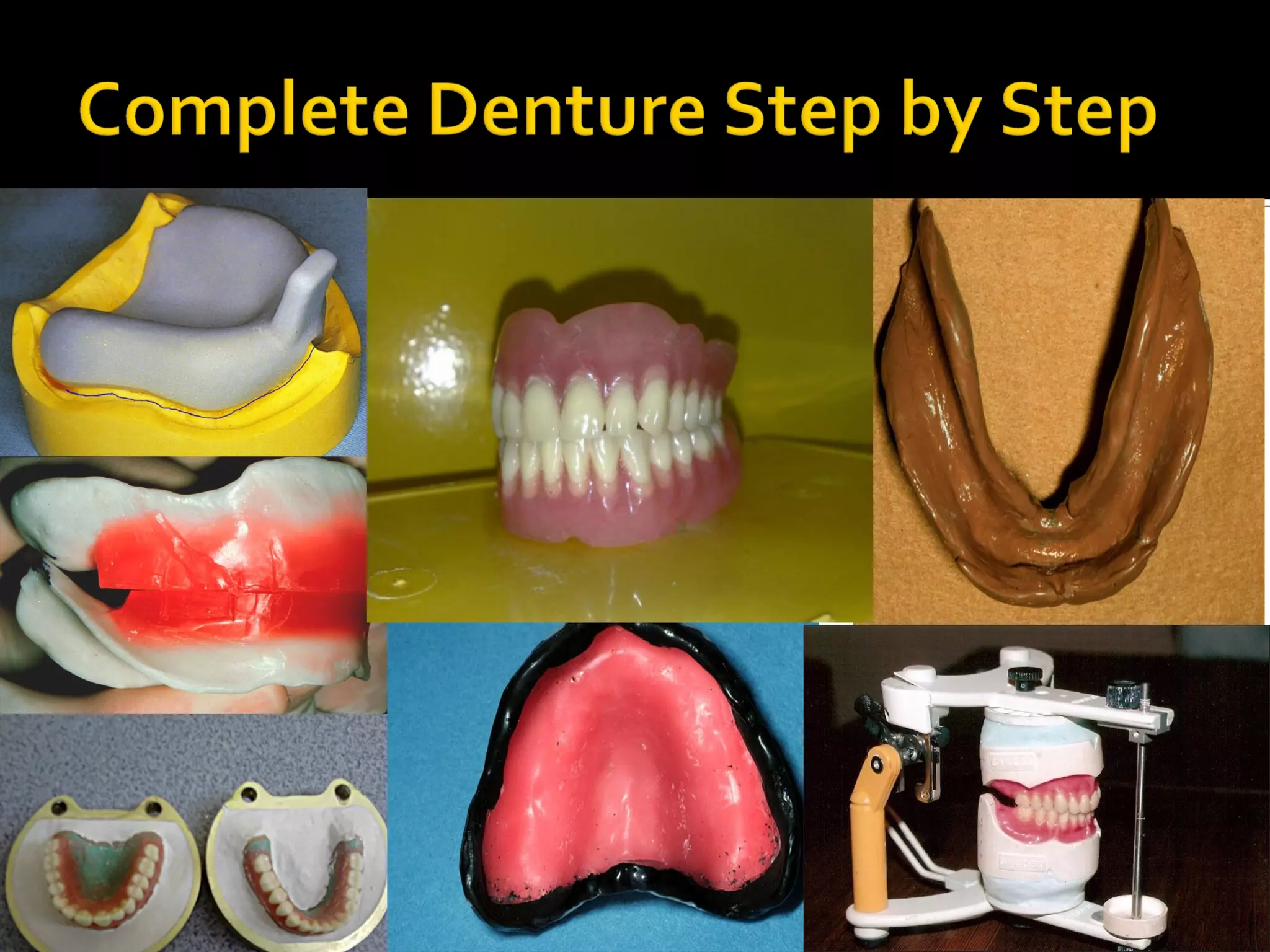 Complete denture prosthodontics step by step | PPT