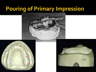 Complete denture prosthodontics step by step | PPT