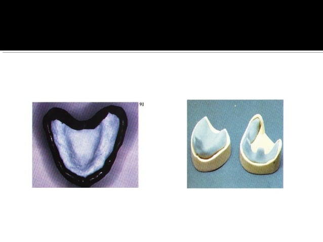 Complete denture prosthodontics step by step | PPT | Dental Health ...