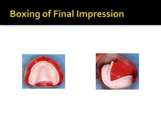 Complete denture prosthodontics step by step | PPT