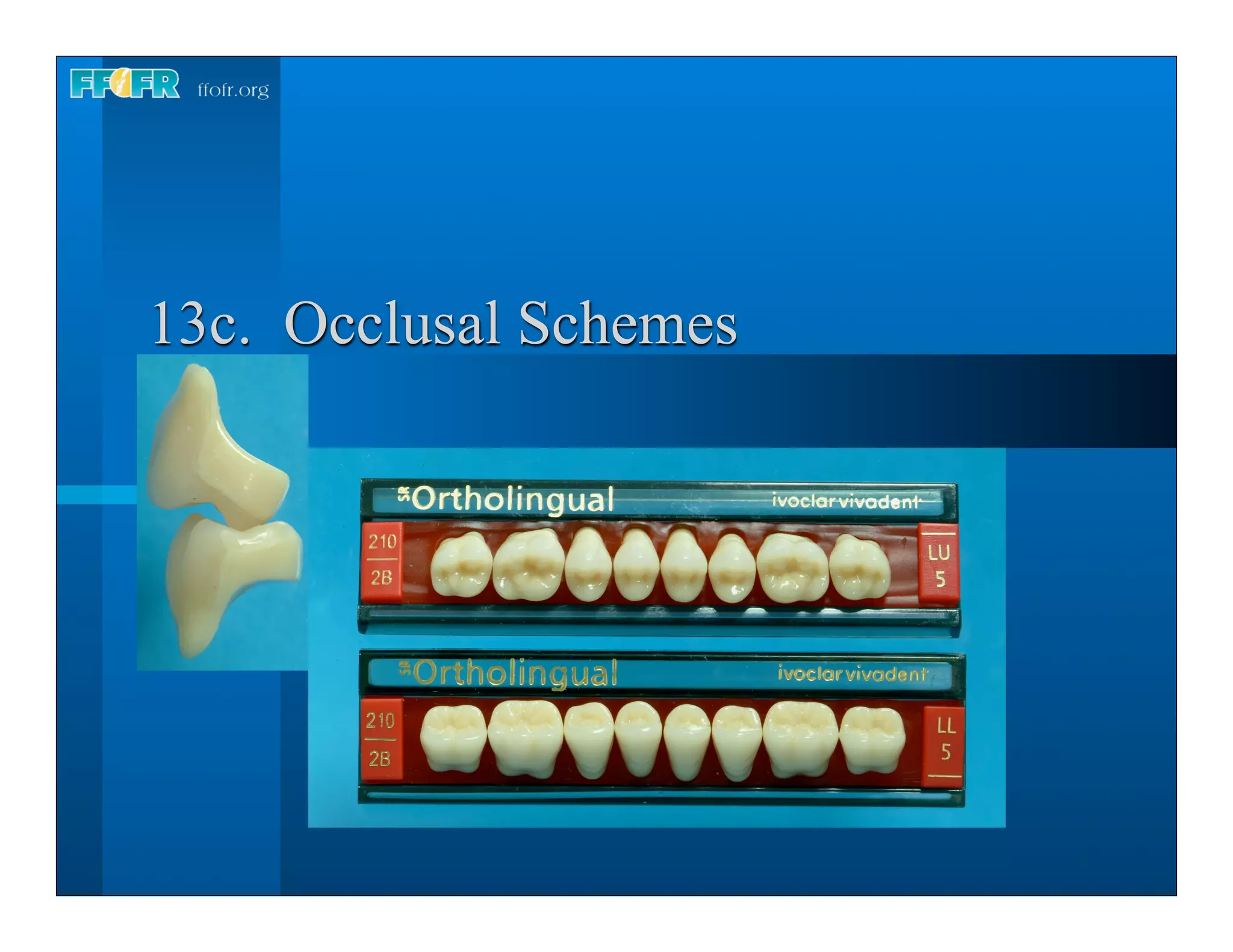 Complete dentures 16.occlusal schemes lingualized occlusion | PDF
