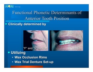 Complete dentures 16.occlusal schemes lingualized occlusion | PDF
