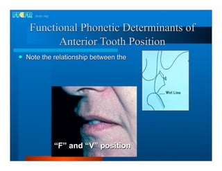 Complete dentures 16.occlusal schemes lingualized occlusion | PDF