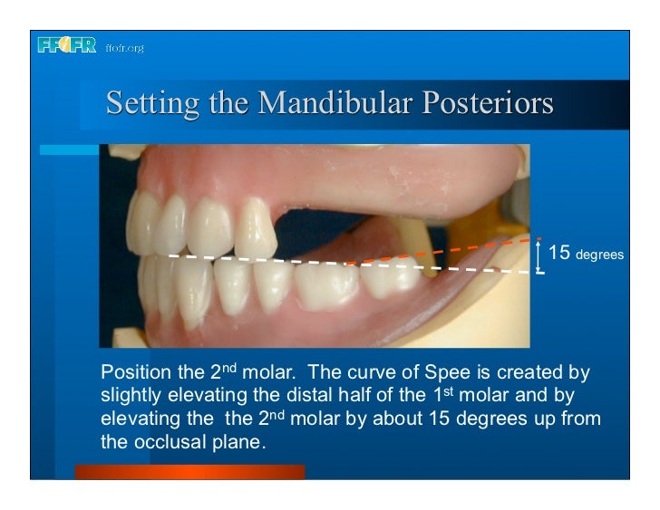 Complete dentures 16.occlusal schemes lingualized occlusion Complete dentures 16.occlusal schemes lingualized occlusion
