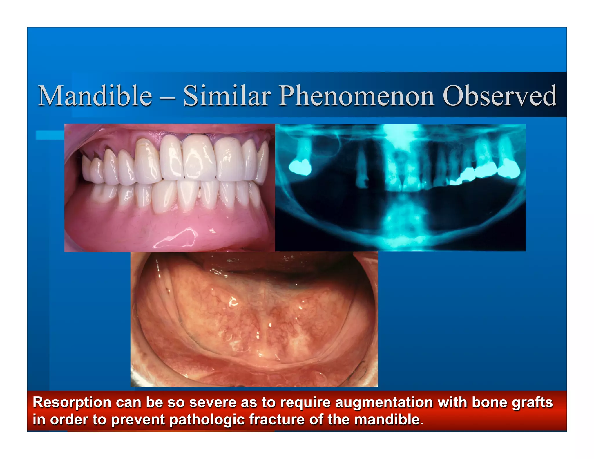 Complete dentures 3.history and exam | PDF