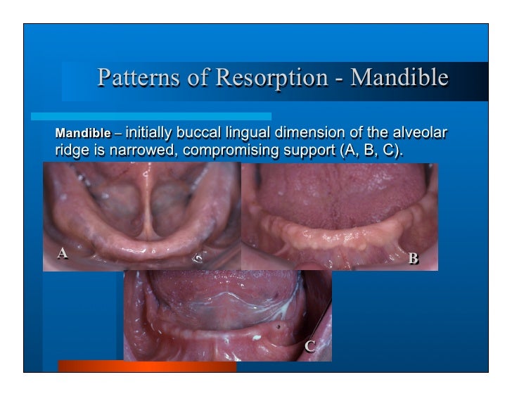 Complete dentures 3.history and exam