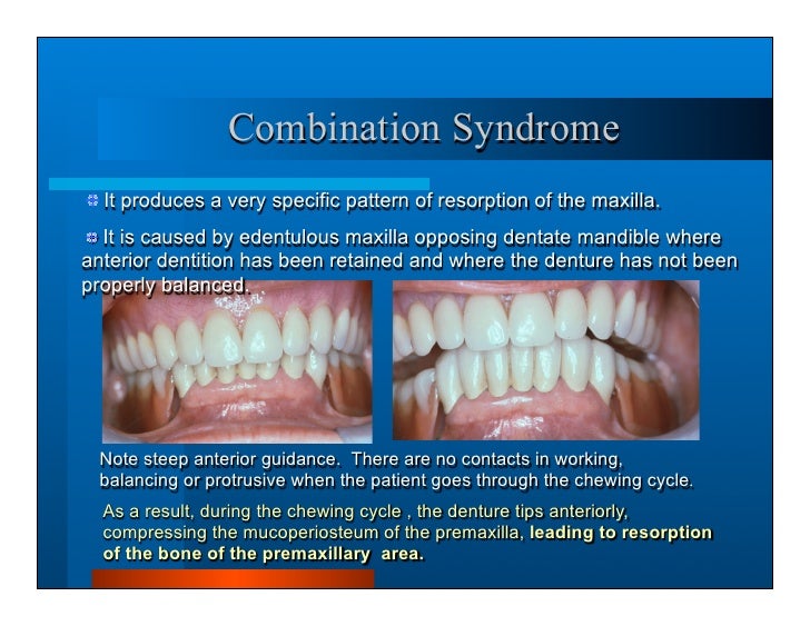 Complete dentures 3.history and exam