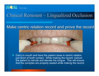 Complete dentures 30. insertion and followup | PDF