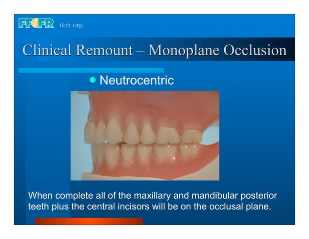 Complete dentures 30. insertion and followup | PDF