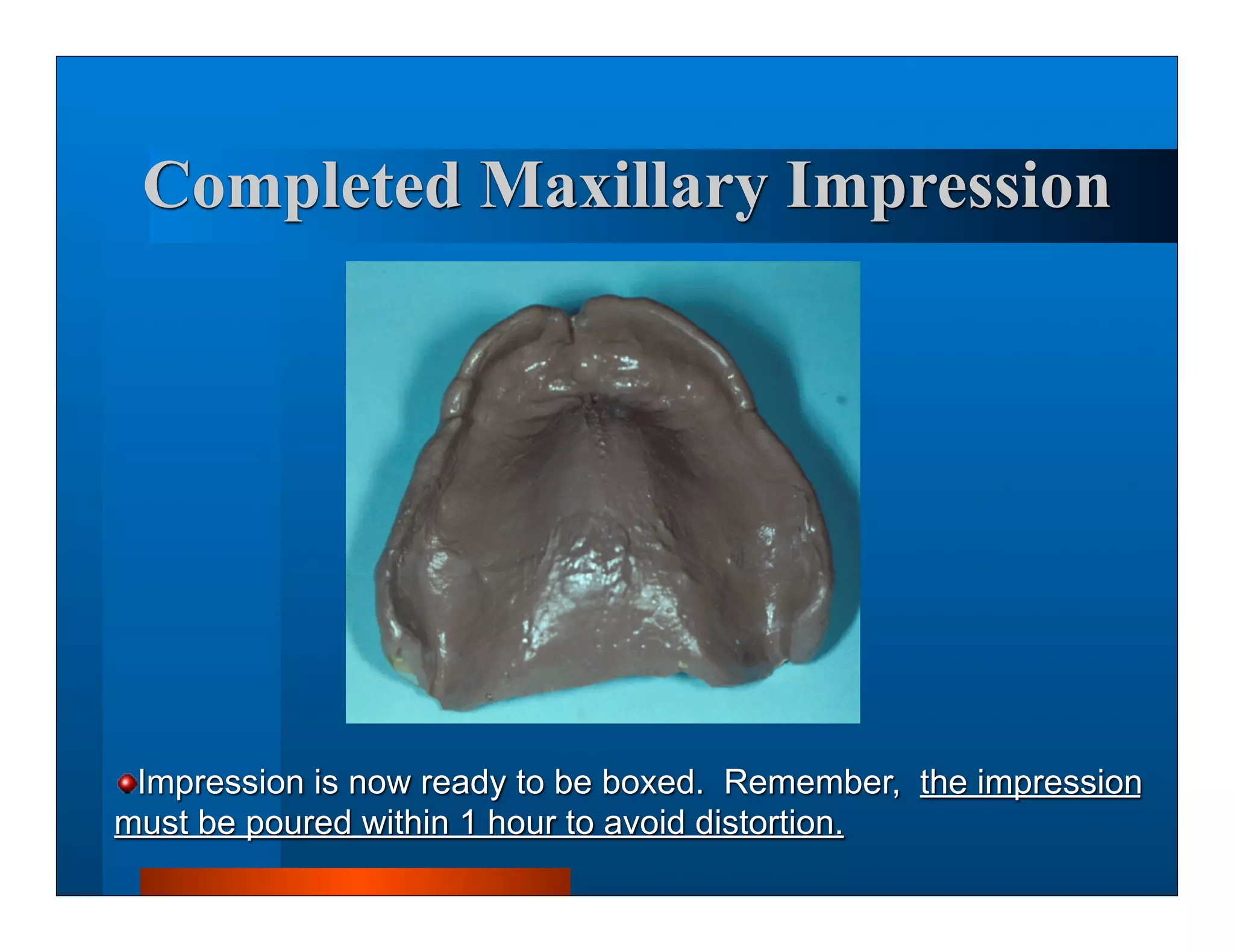 Complete dentures 7. final impressions | PDF