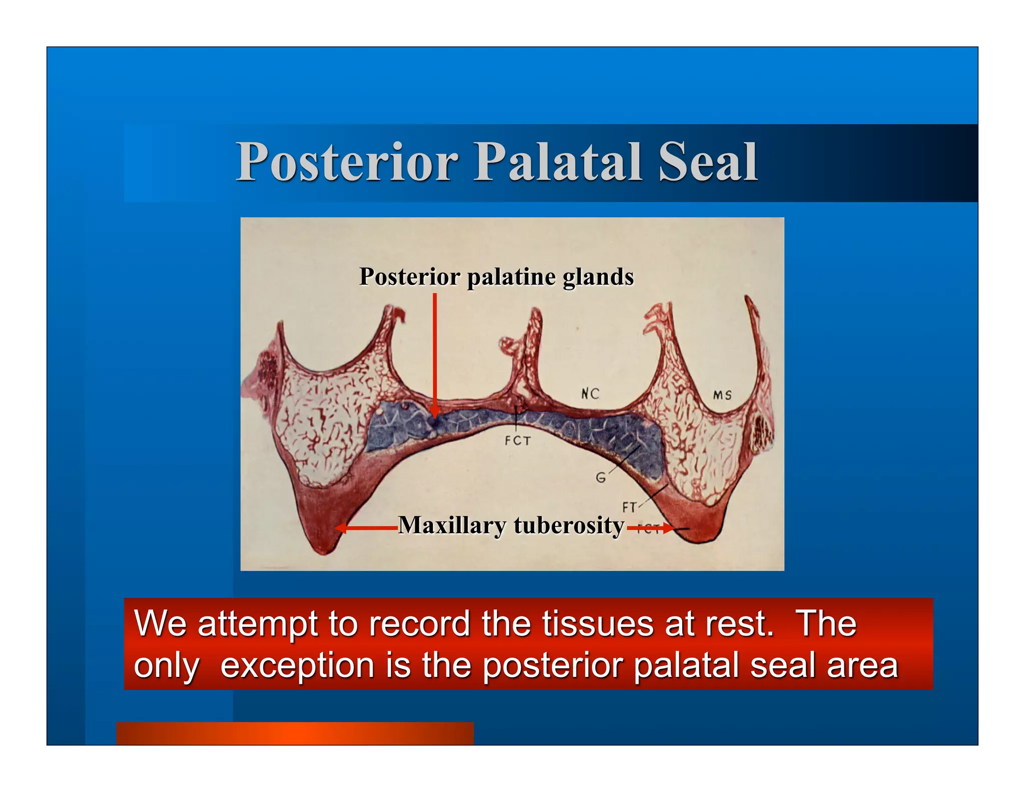 Complete dentures 7. final impressions | PDF