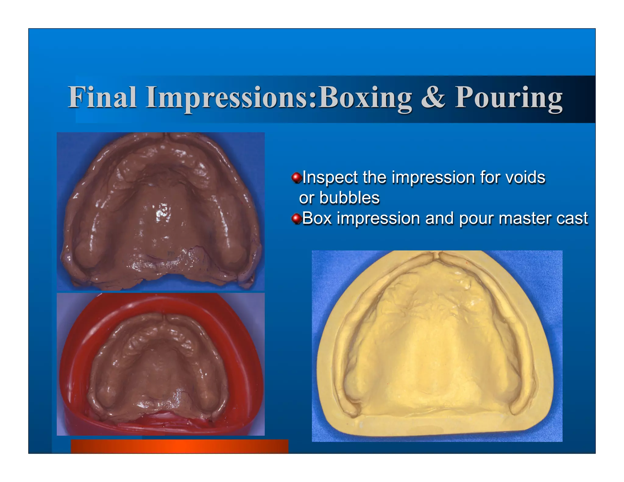 Complete dentures 7. final impressions | PDF