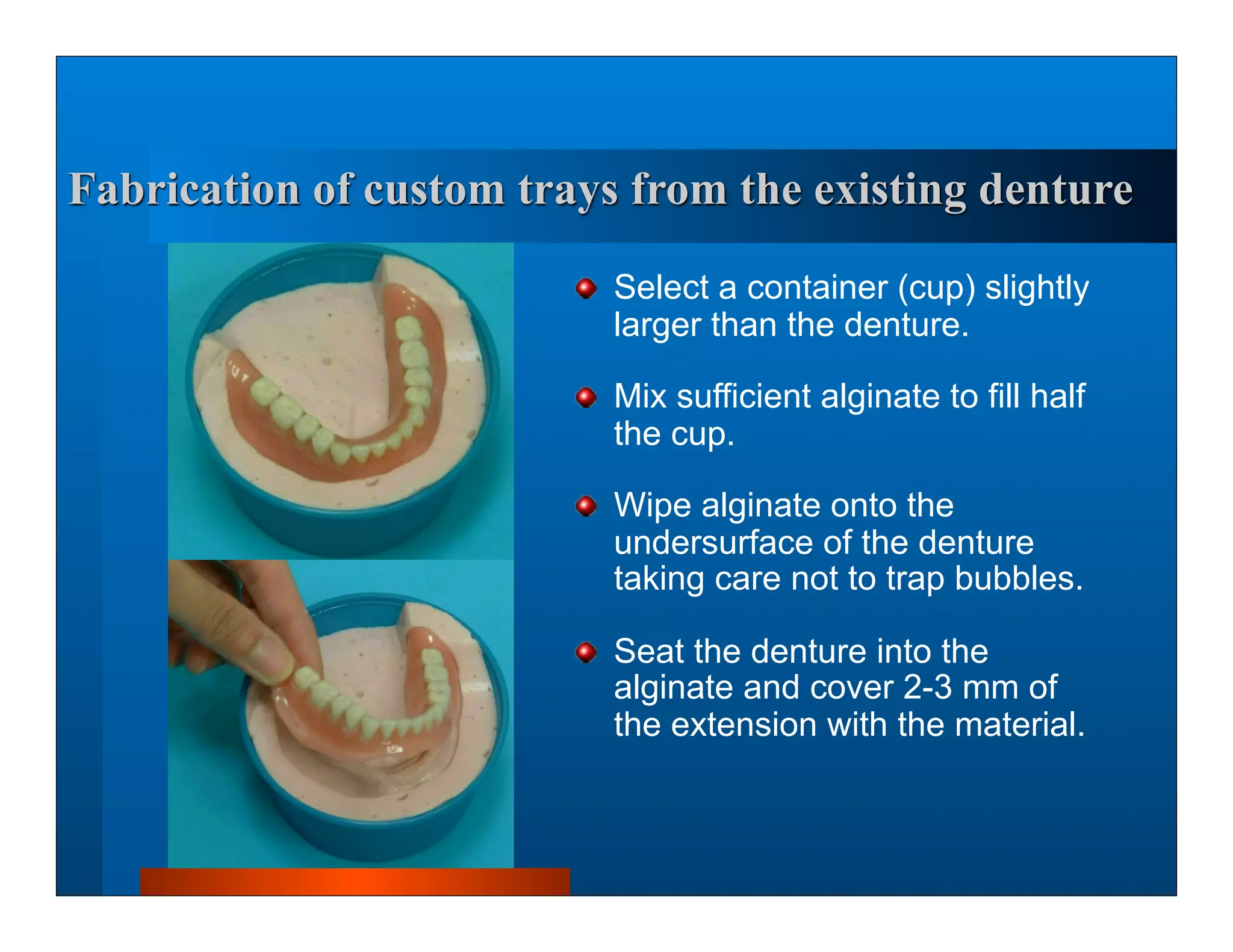 Complete dentures 7. final impressions | PDF