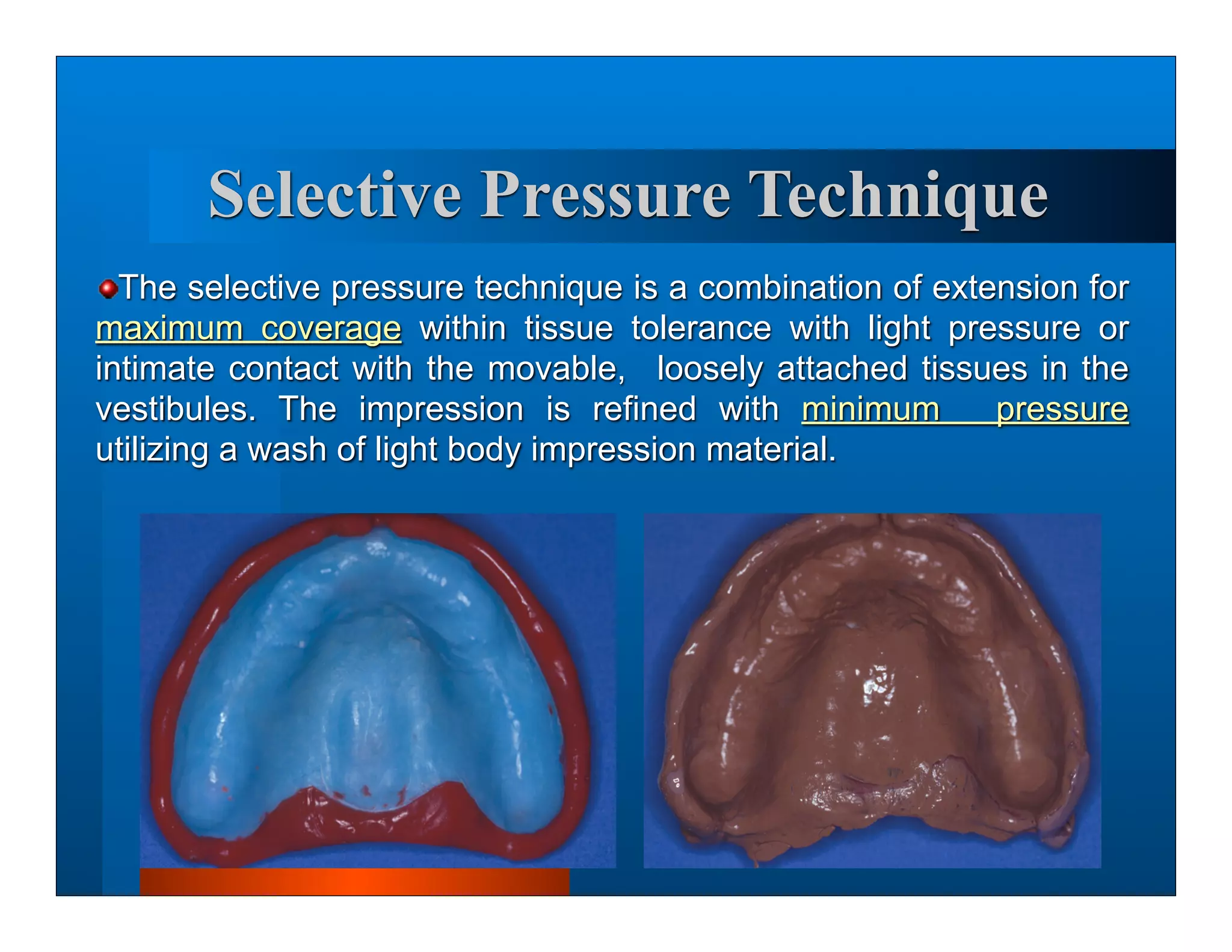 Complete dentures 7. final impressions | PDF