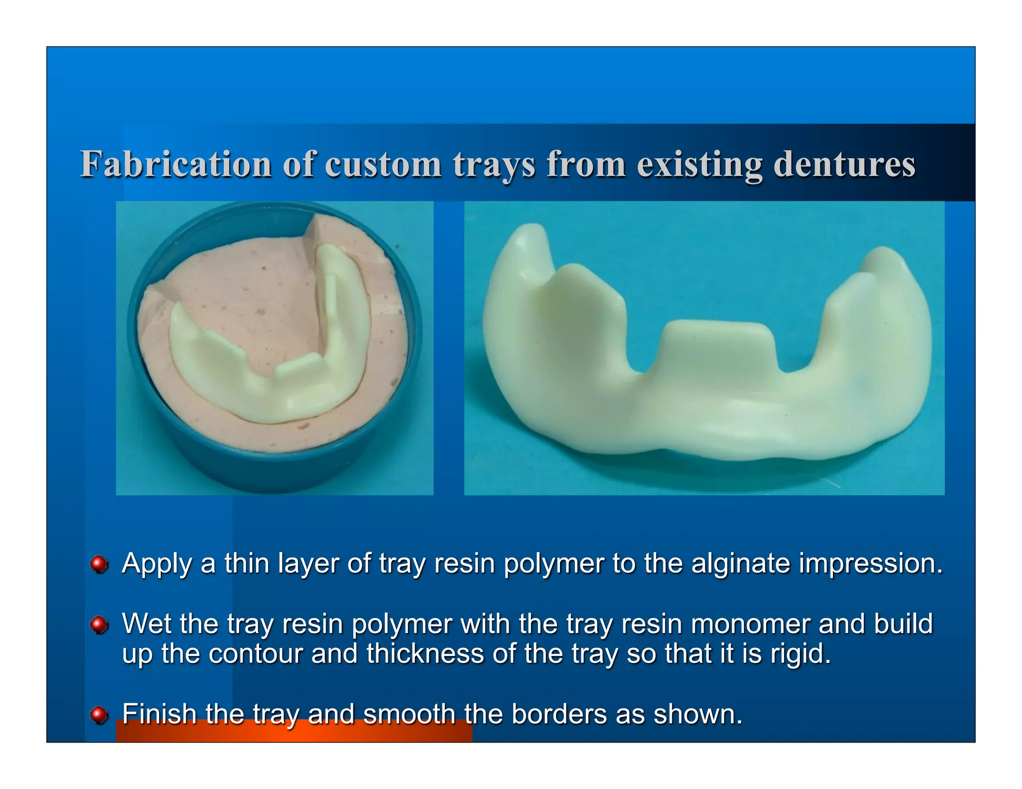 Complete dentures 7. final impressions | PDF
