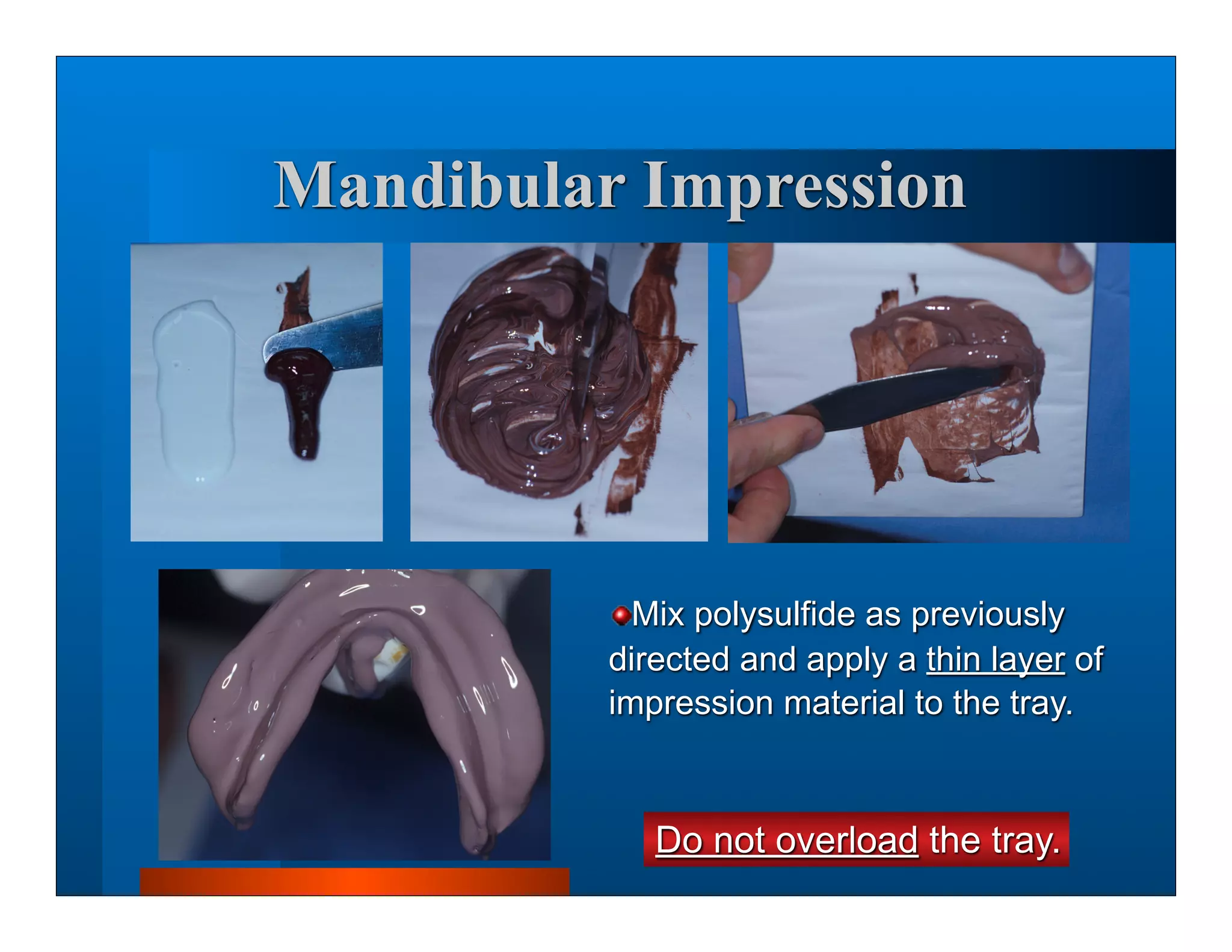 Complete dentures 7. final impressions | PDF