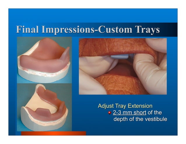 Complete dentures 7. final impressions | PDF