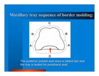 Complete dentures 7. final impressions | PDF