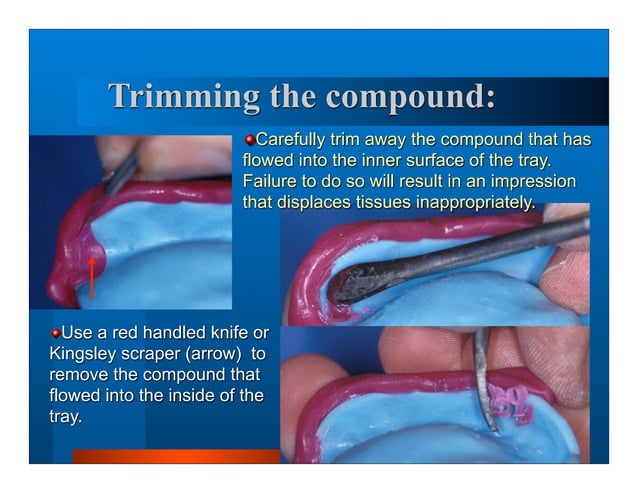 Complete dentures 7. final impressions | PDF