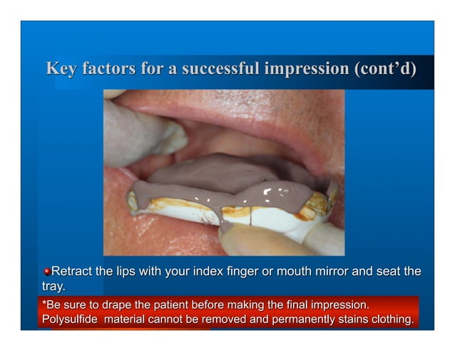 Complete dentures 7. final impressions | PDF