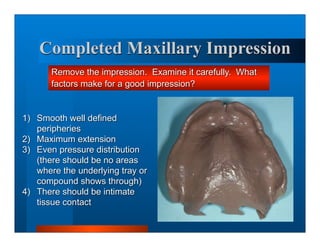 Complete dentures 7. final impressions | PDF