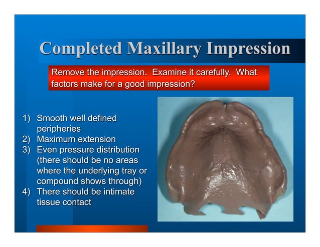 Complete dentures 7. final impressions | PDF