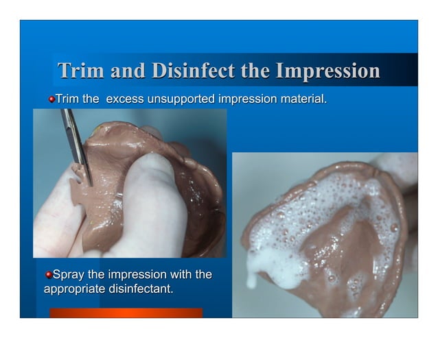 Complete dentures 7. final impressions | PDF