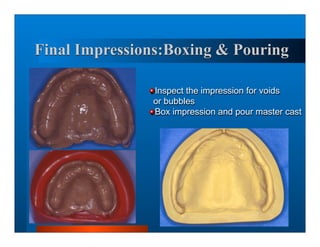 Complete dentures 7. final impressions | PDF