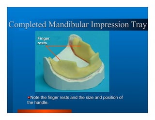 Complete dentures 7. final impressions | PDF