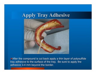 Complete dentures 7. final impressions | PDF