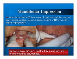 Complete dentures 7. final impressions | PDF