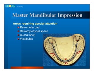 Retromylohyoid Space