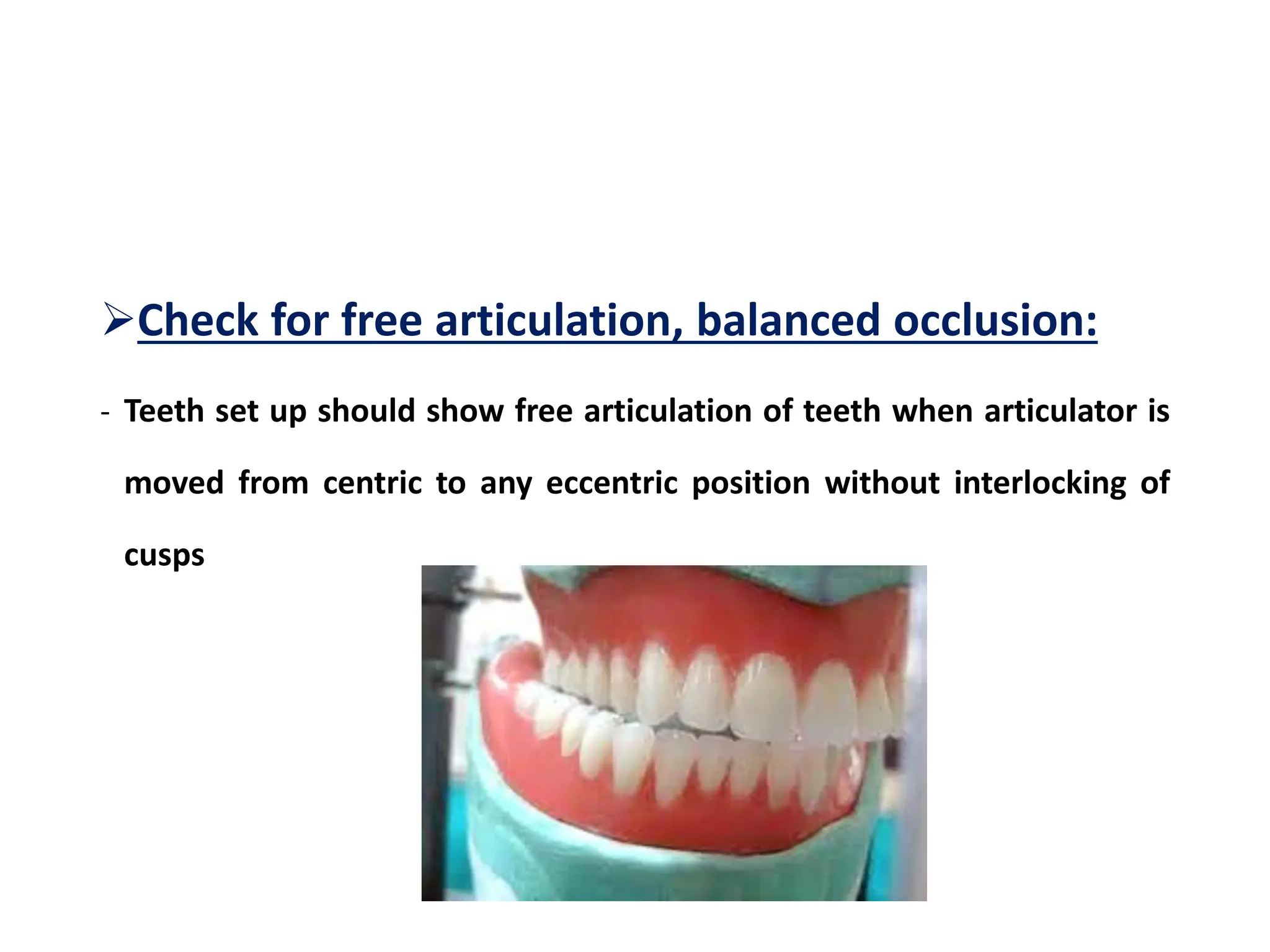try-in of Complete removable denture .pdf
