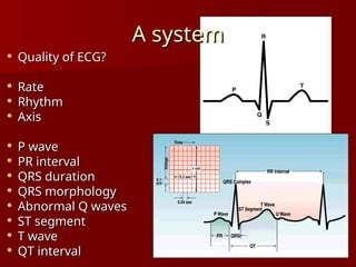 complete ECG interpretation presentation.ppt