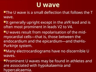 complete ECG interpretation presentation.ppt