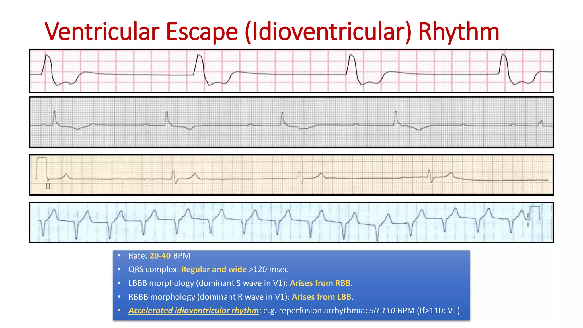 Complete EKG Interpretation Course | PPTX