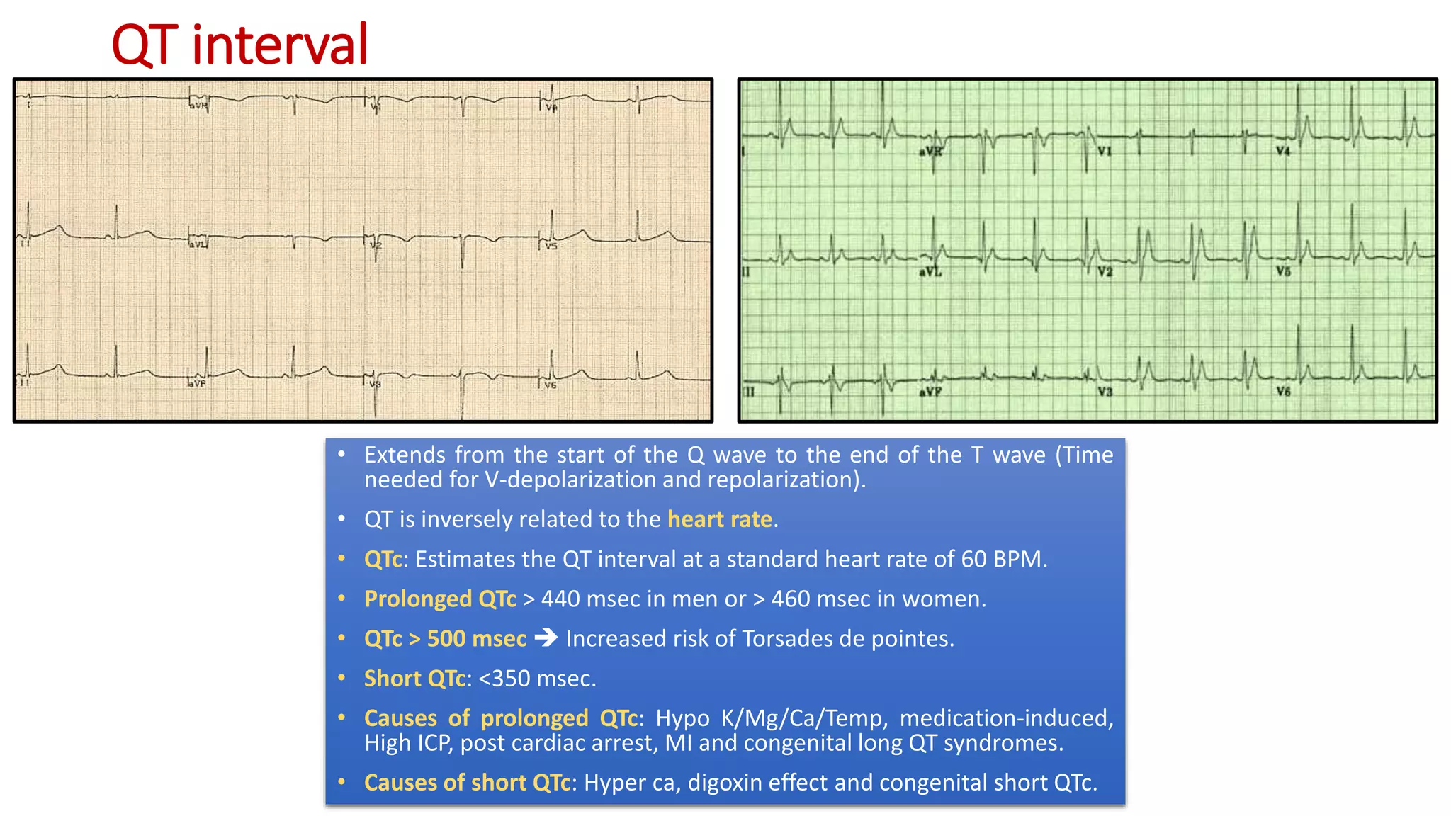 Complete EKG Interpretation Course | PPTX