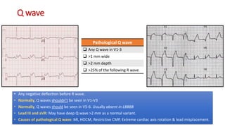 Complete EKG Interpretation Course | PPTX
