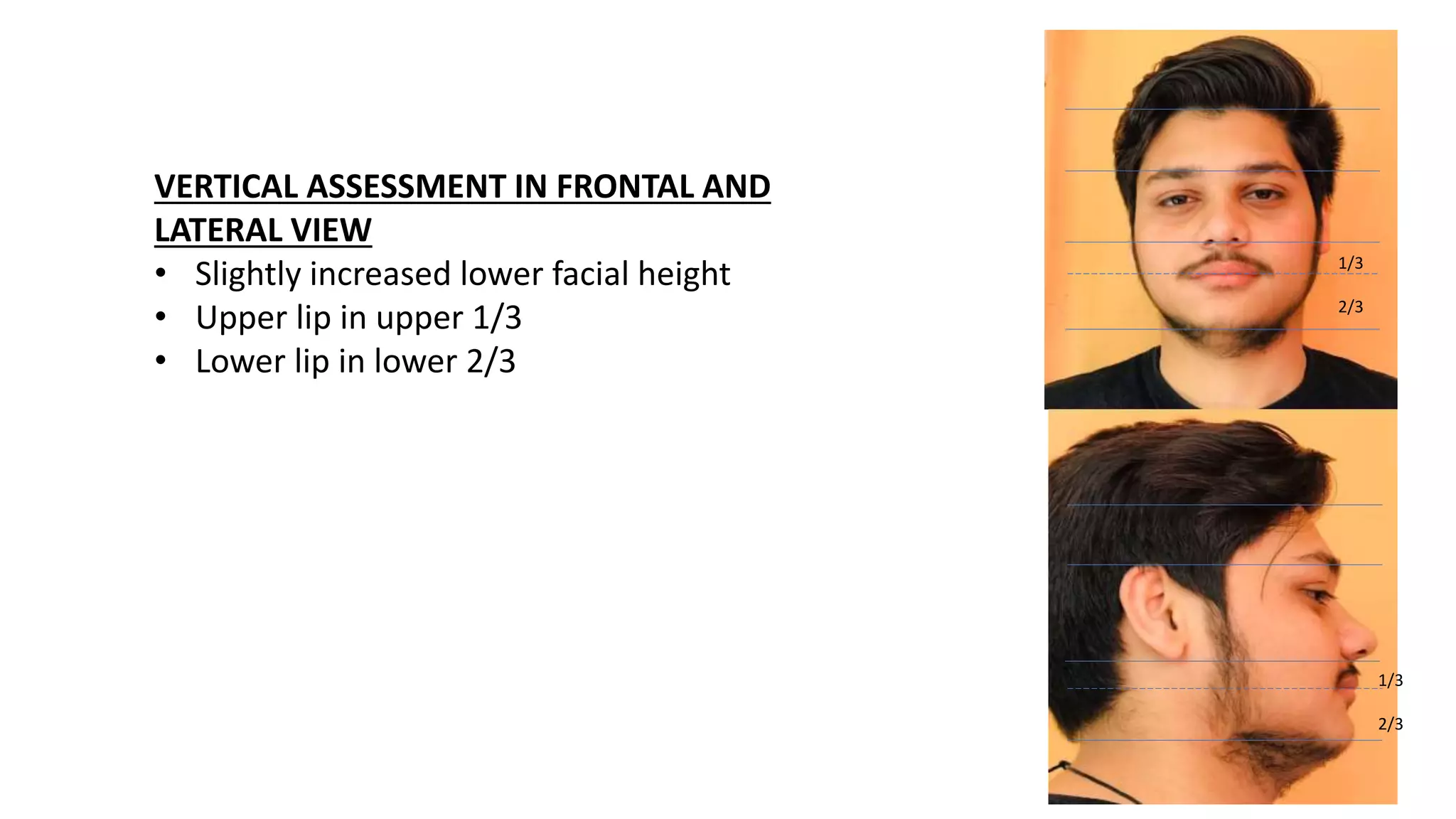 Complete esthetic analysis | PPTX