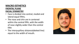 Complete esthetic analysis | PPTX