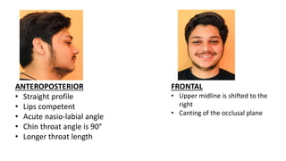 Complete esthetic analysis | PPTX