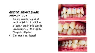 Complete esthetic analysis | PPTX