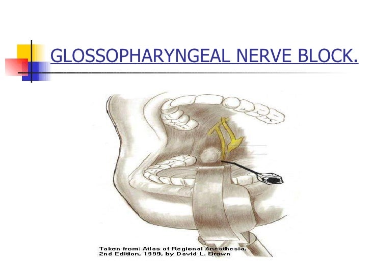 Glossopharyngeal Nerve Block